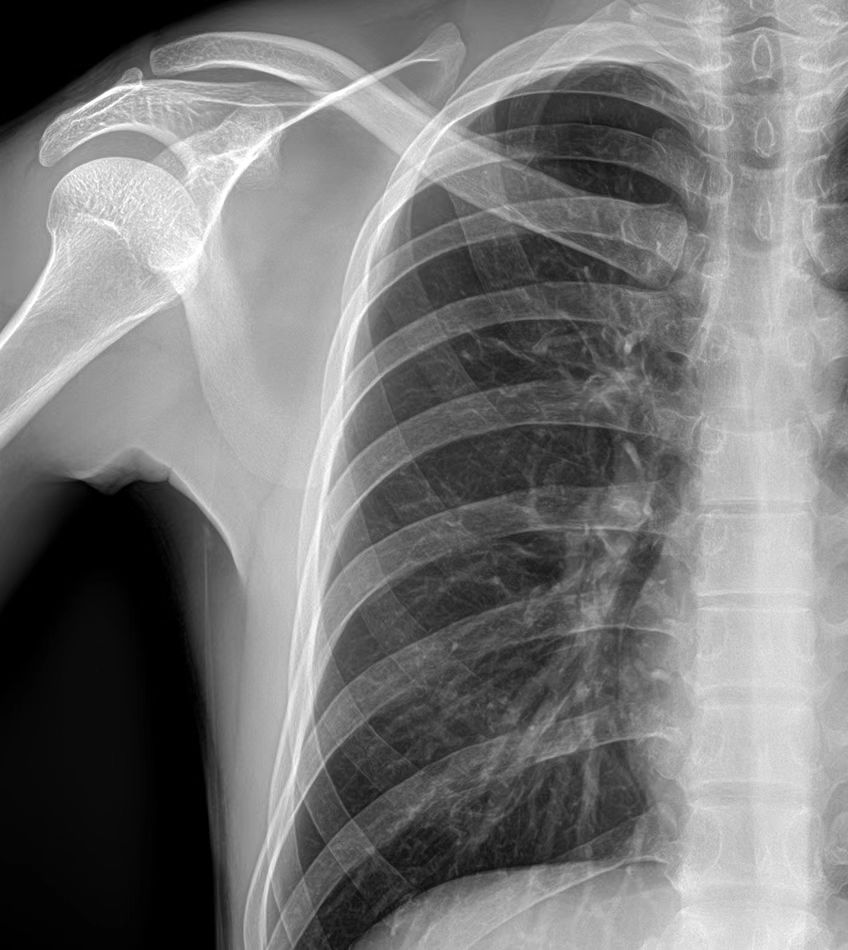 PZDR INTRODUCTION PZ Medical PZDR INTRODUCTION PZ Medical